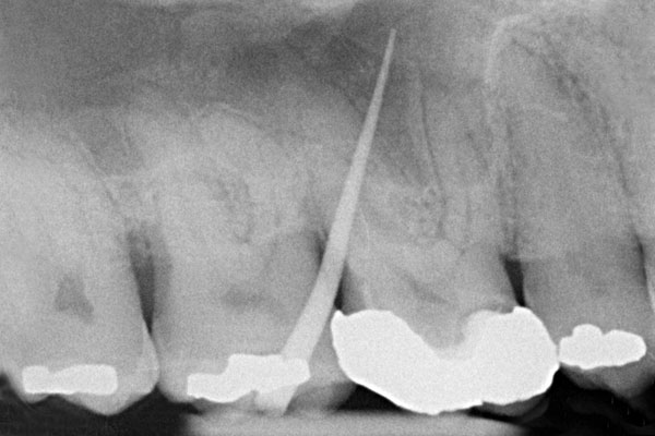 G3 ZAHNARZTPRAXIS | Endodontologie